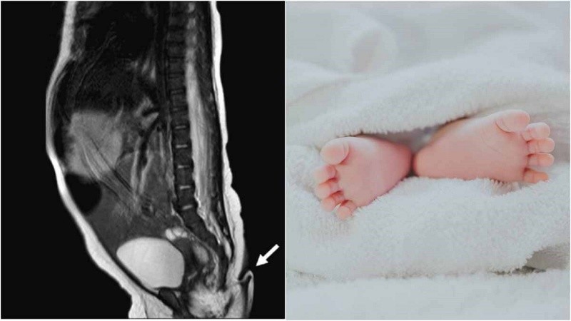 Qué es la cola en México [Actualizado 2025]